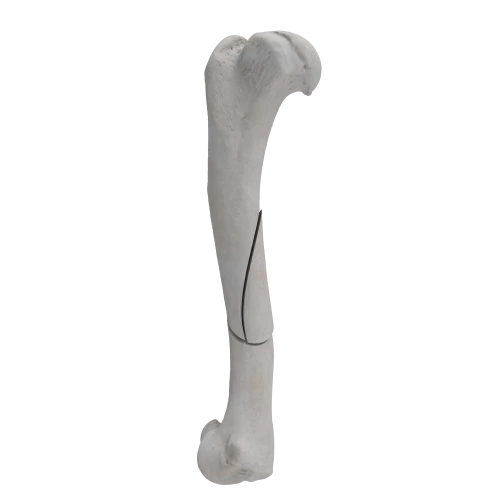 Humerus - Canine - Fracture 12-B1 acc. to AOVet CABIOMEDE